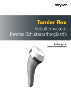 Tornier Flex | Stryker
